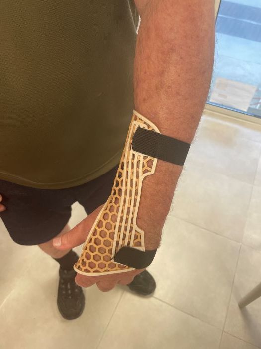 Parametric wrist orthesis by HumanlabSP - Thingiverse