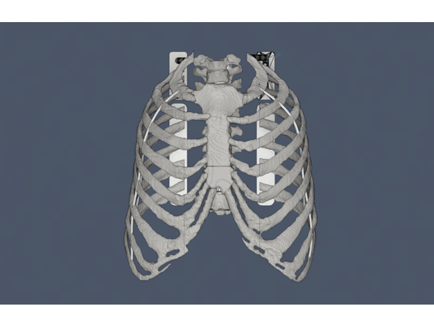 Thingiverse - Emergency Department Clamshell Thoracotomy Simulator by OSHCS